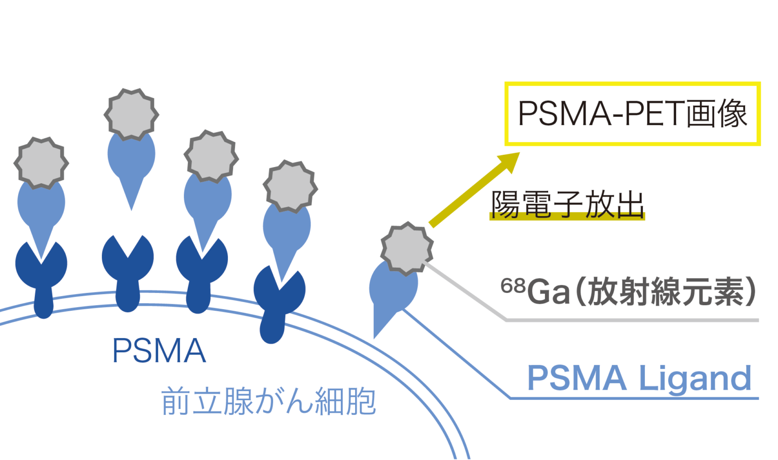 前立腺がんにおけるPSMA-PET検査の有用性 - 宇都宮セントラルクリニック 放射線治療センター
